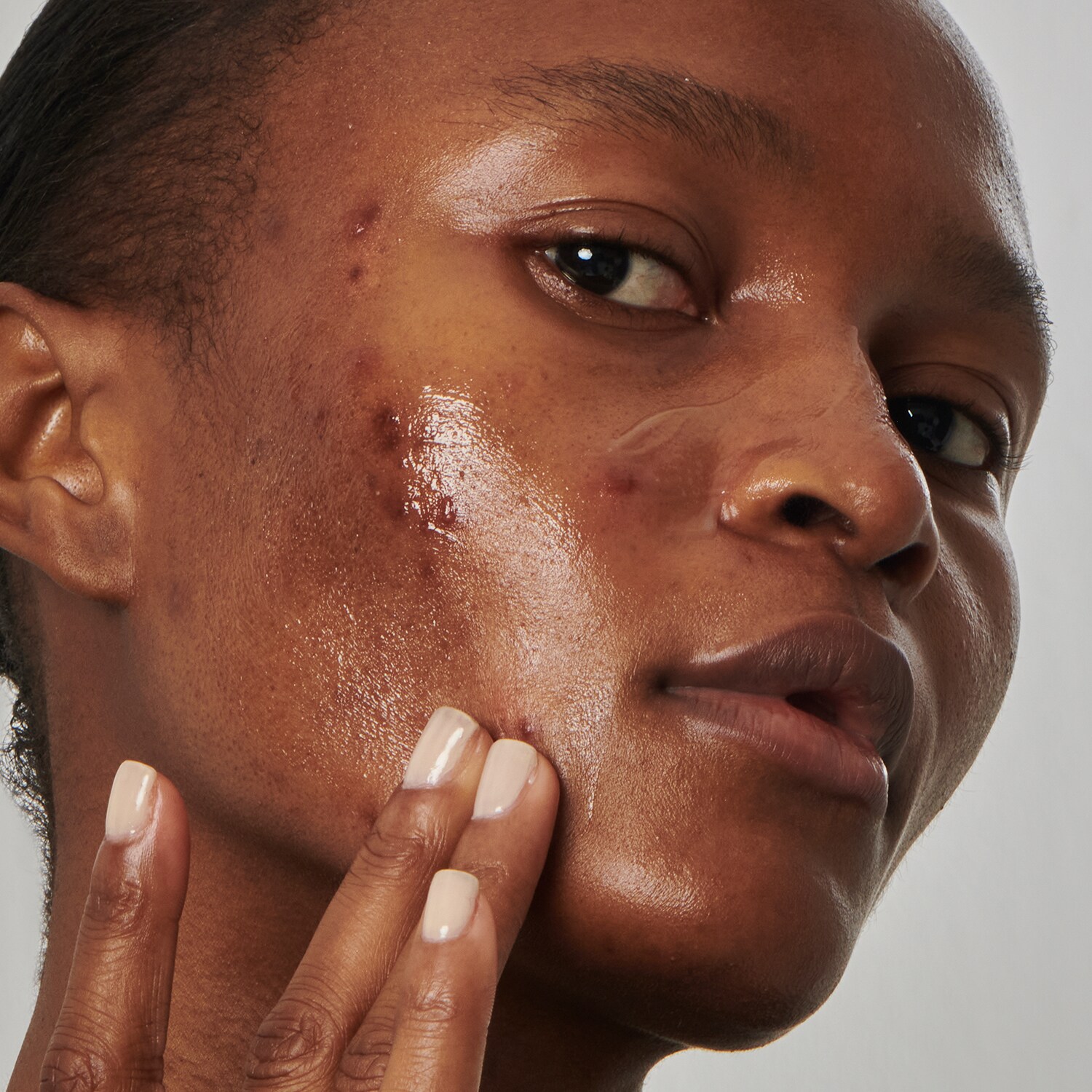 Soluzione per l'eccesso di sebo con niacinamide 20% - Siero per il viso ...