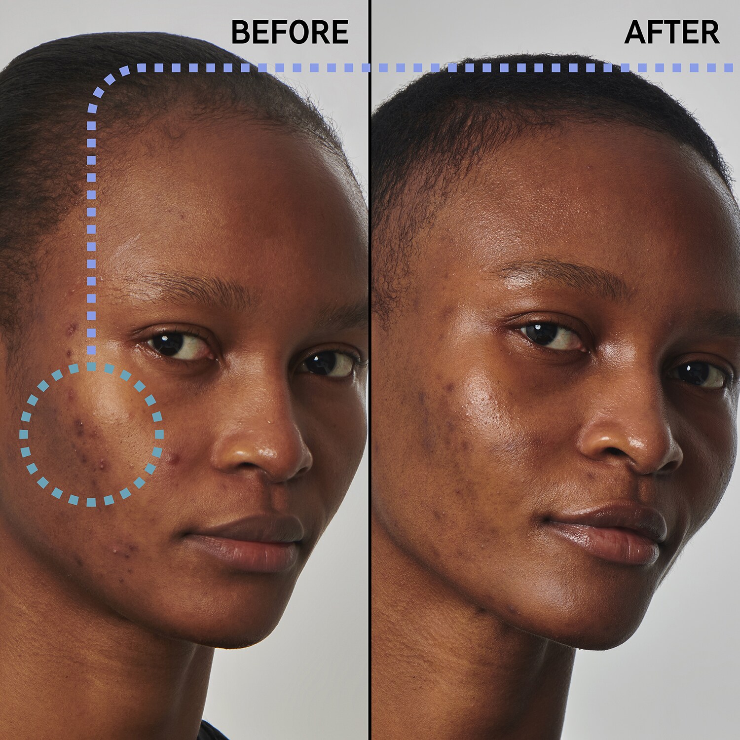 Soluzione per l'eccesso di sebo con niacinamide 20% - Siero per il viso ...